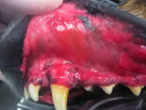 Chronic Ulcerative Paradental Syndrome